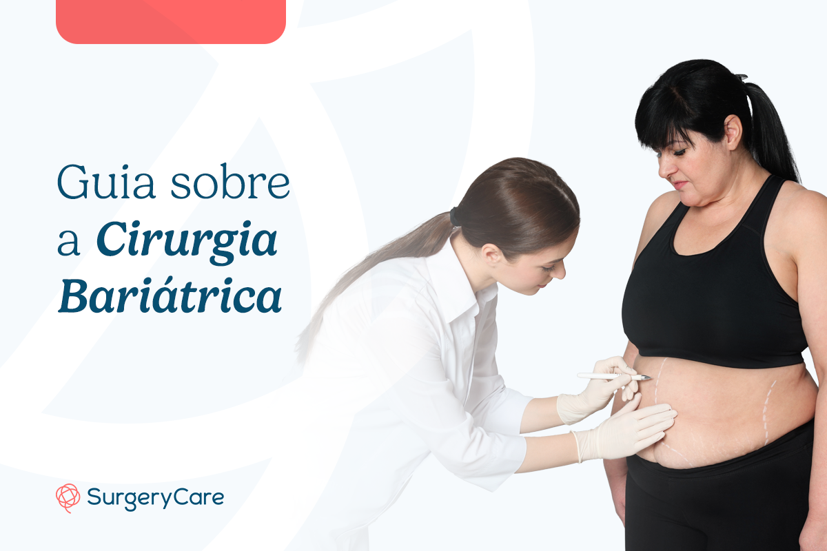 Guia sobre a cirurgia bariátrica