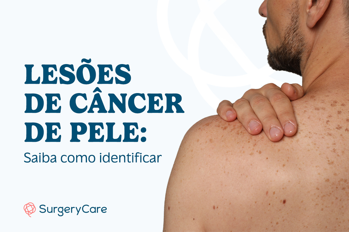 Lesões de câncer de pele: saiba como identificar